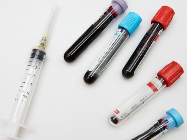 Ultimate Guide to Phlebotomy Test Tube Colors: What Each Color Means ...
